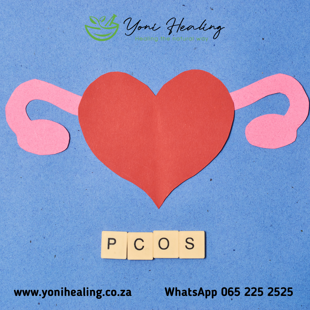 𝗣𝗼𝗹𝘆𝗰𝘆𝘀𝘁𝗶𝗰 Ovarian 𝗦𝘆𝗻𝗱𝗿𝗼𝗺𝗲 (𝗣𝗖𝗢𝗦) | Amenorrhea – Yoni Healing